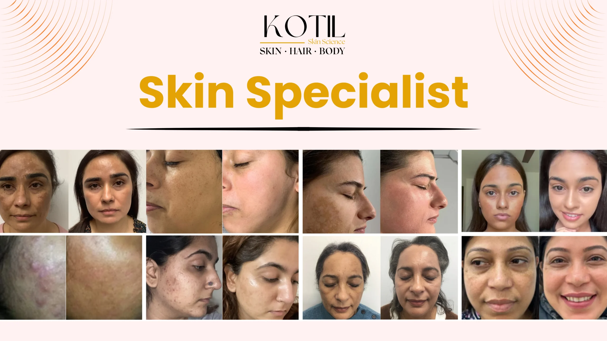 Skin Specialist in India 2025: Treatments, Results, Care | Kotil Skin